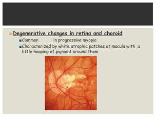 REFRACTIVE ERROR MYOPIA AND ITS MANAGEMENT.pptx