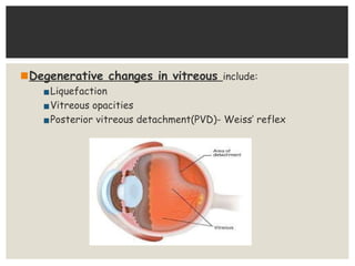 REFRACTIVE ERROR MYOPIA AND ITS MANAGEMENT.pptx