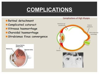 REFRACTIVE ERROR MYOPIA AND ITS MANAGEMENT.pptx