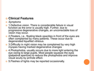 myopia 1.pptx Ophthalmology MBBS 3rd year | PPTX