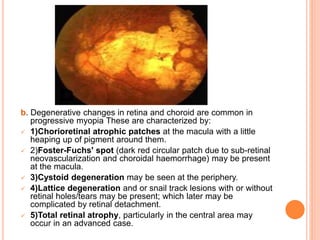 myopia 1.pptx Ophthalmology MBBS 3rd year | PPTX