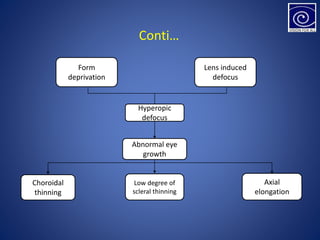 Myopia classification ,prevalence , pathological myopia & its control ...