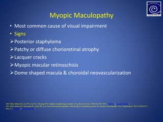 Myopia classification ,prevalence , pathological myopia & its control ...
