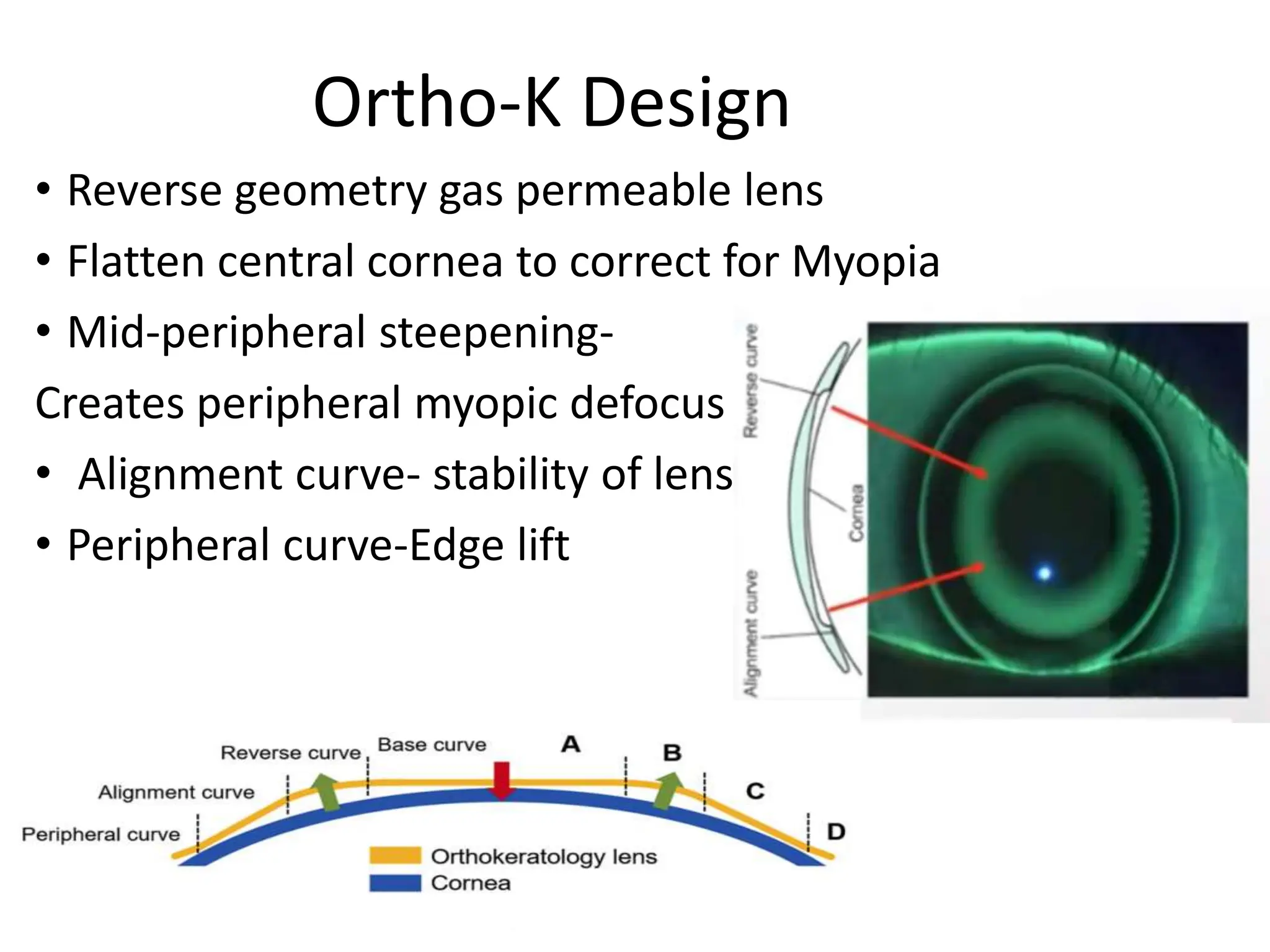 Myopia Management & Control Strategies.pptx