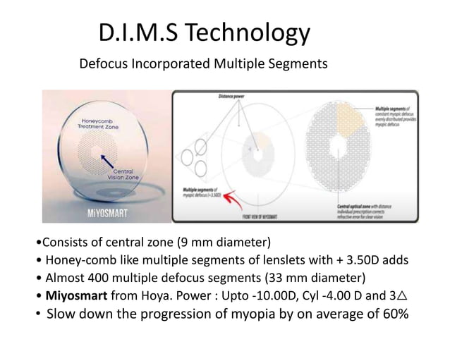 Myopia Management & Control Strategies.pptx