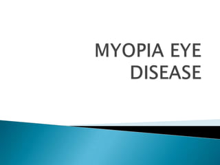 Myopia eye disease | PPT