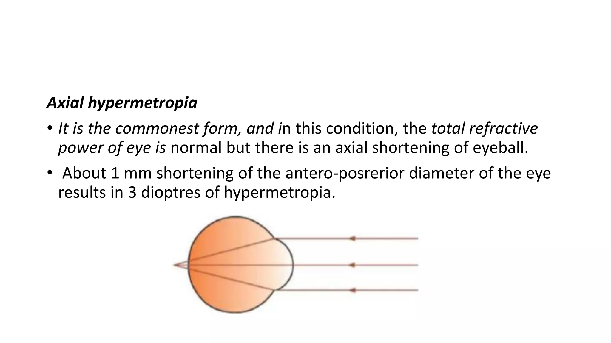 myopia & hypermetropia.pptx