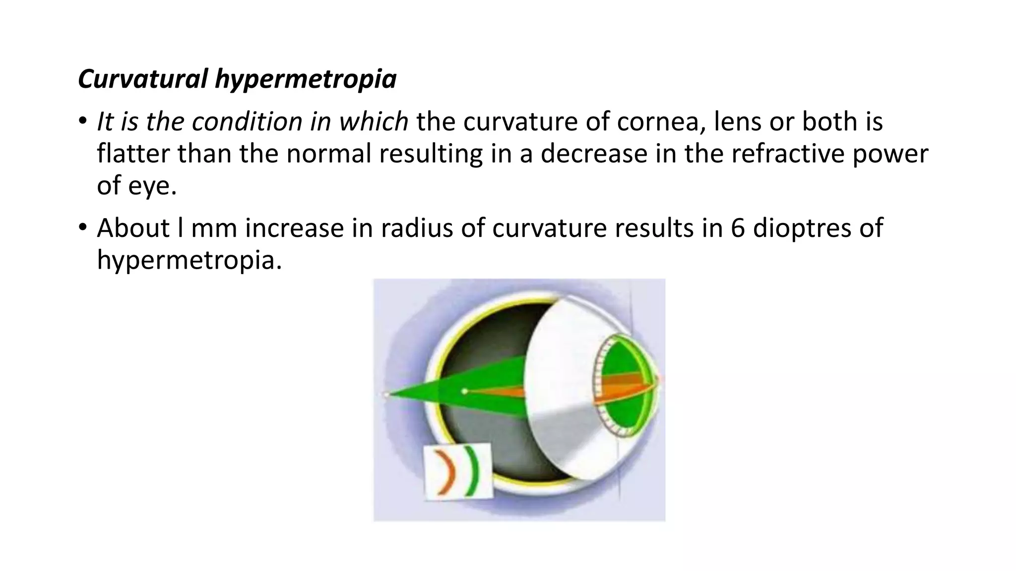 myopia & hypermetropia.pptx