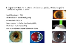 myopia & hypermetropia.pptx