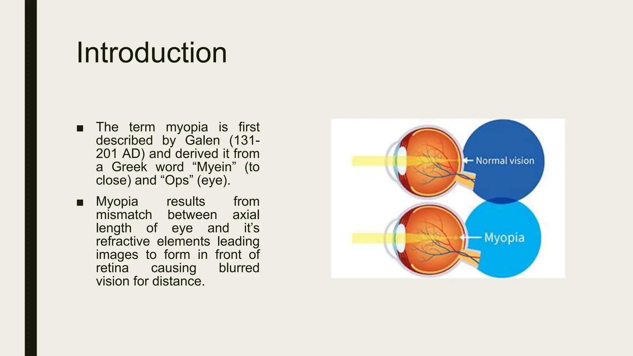myopia management new researches.....pptx