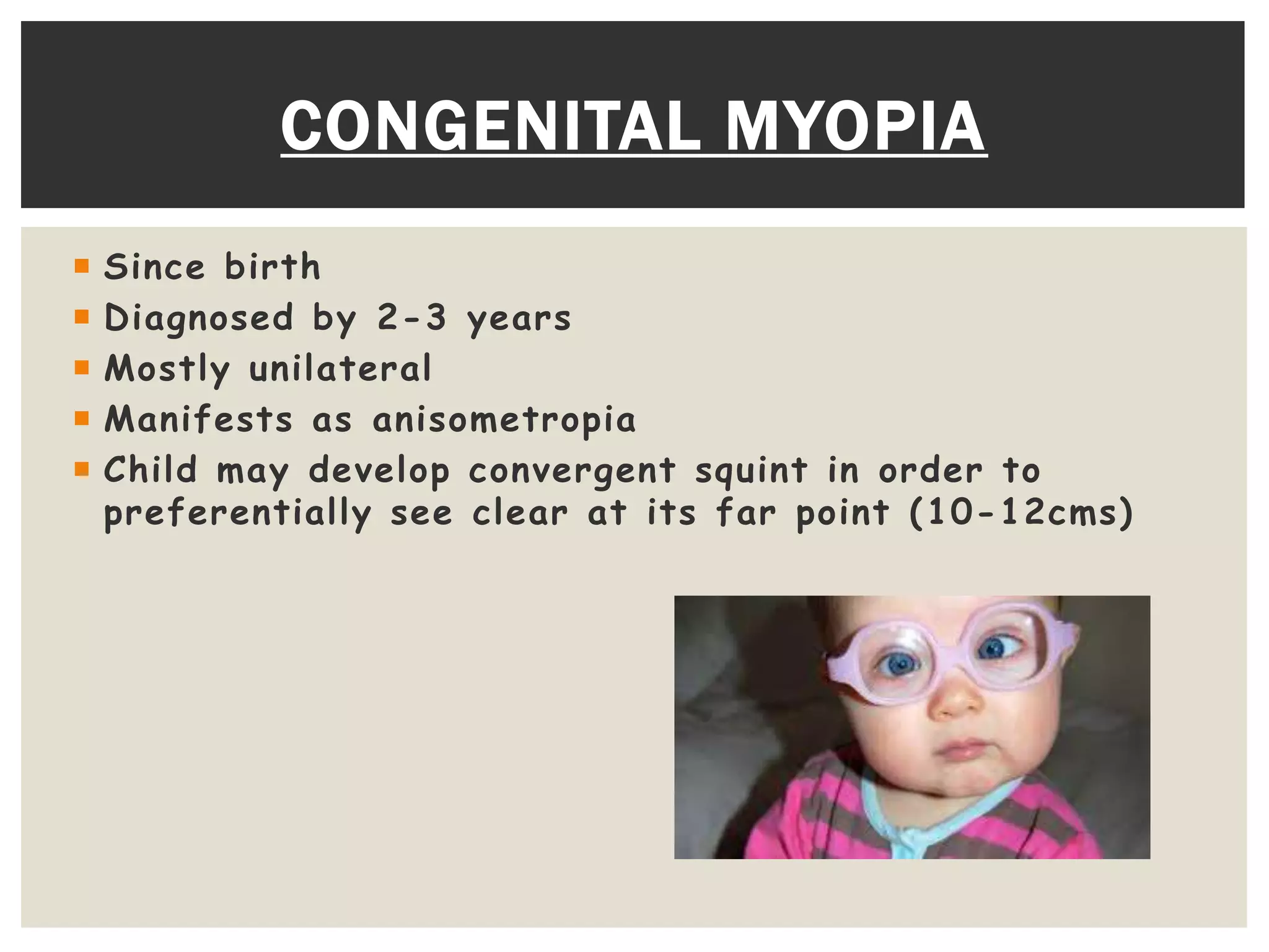 Myopia | PPTX