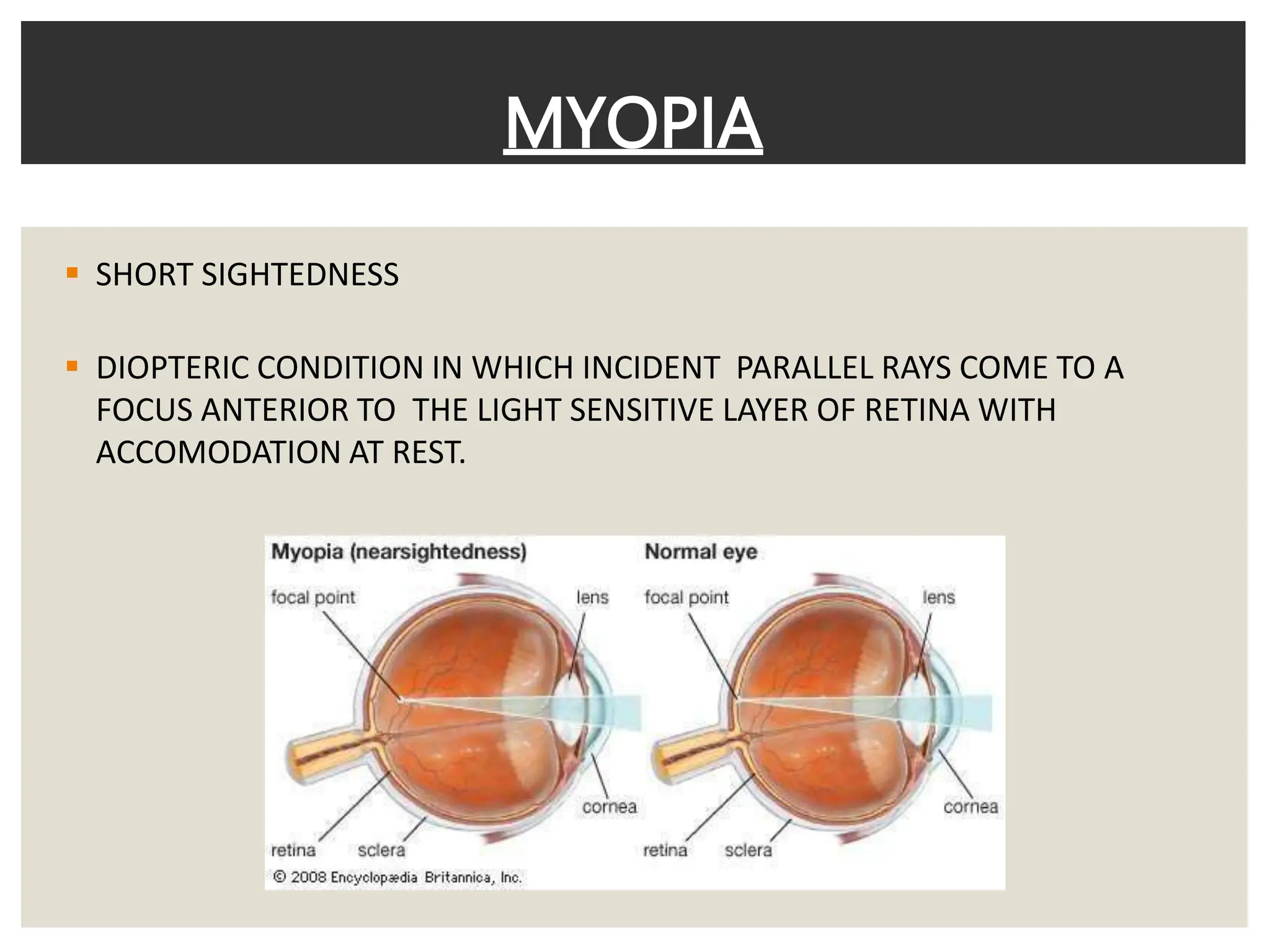 MYOPIA CLINICAL | PPT