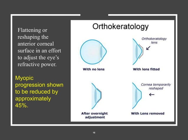myopia new aioc.pptx