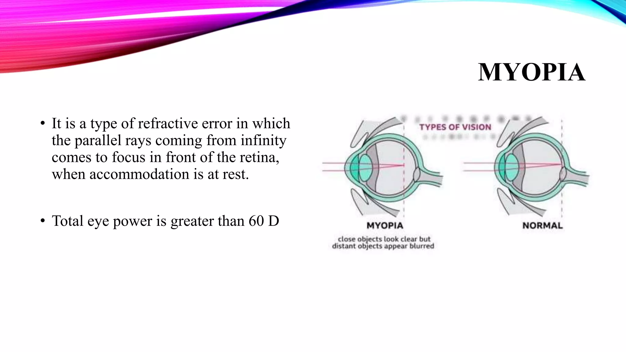Myopia progression | PPTX