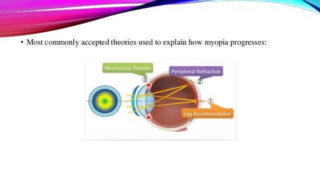Myopia progression