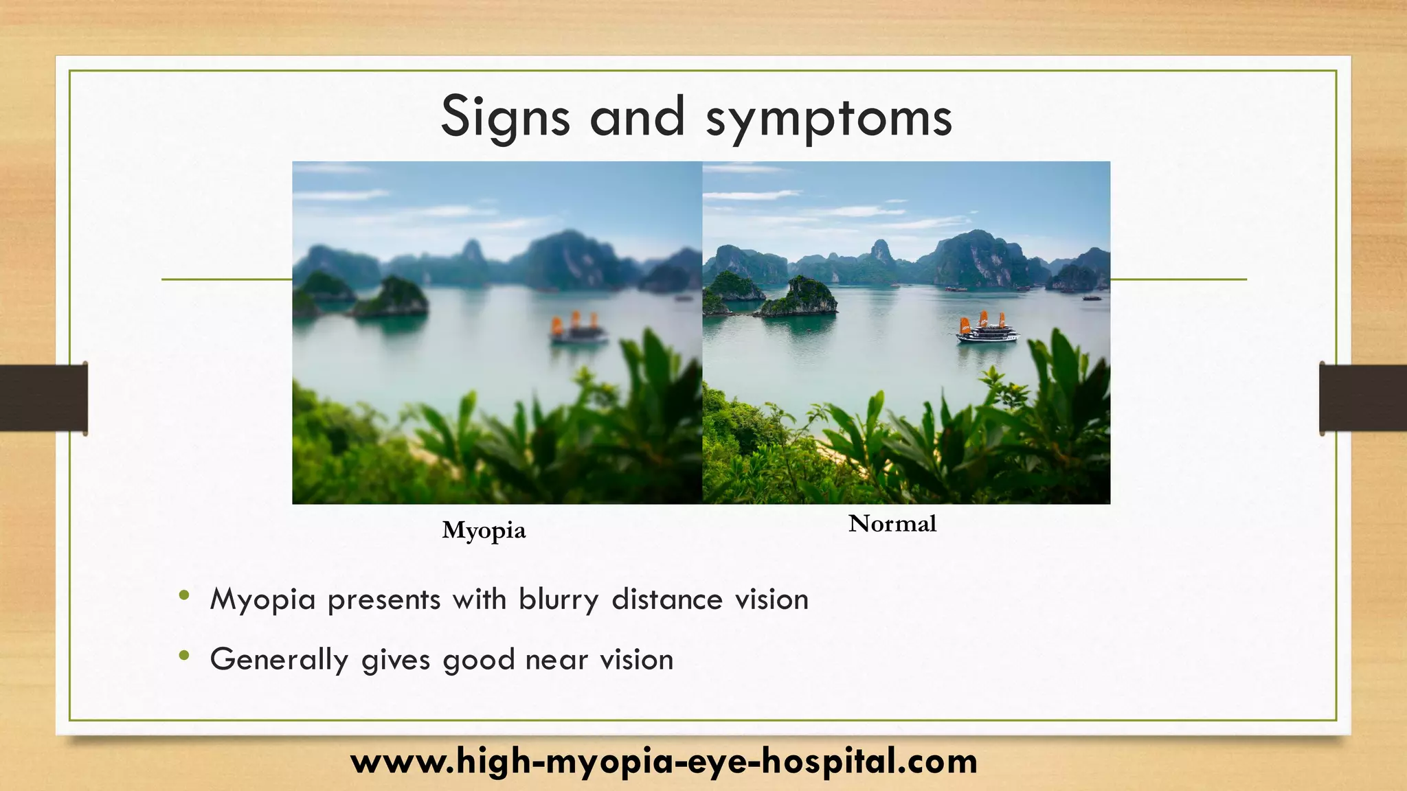 Myopia treatment in india | PDF