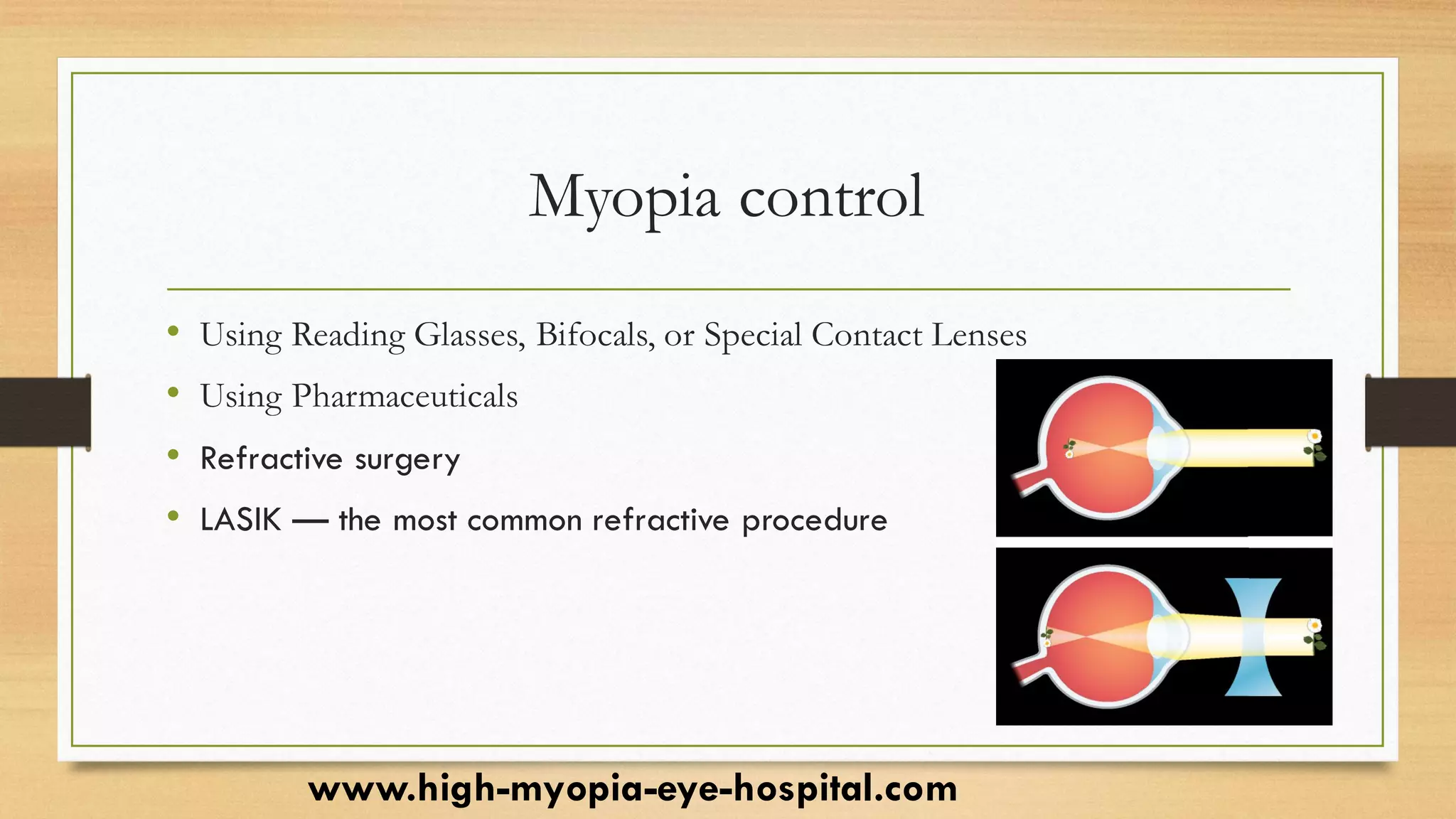 Myopia treatment in india | PDF