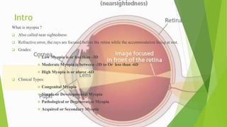 Myopic maculopathy in Pathological Myopia | PPTX