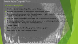 Myopic maculopathy in Pathological Myopia | PPTX