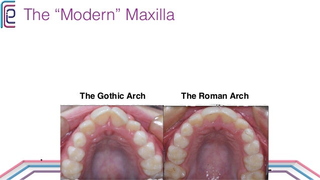 My orthodontic journey 2014