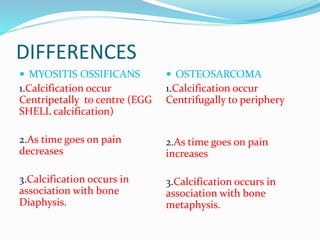 Myositis ossificans | PPTX