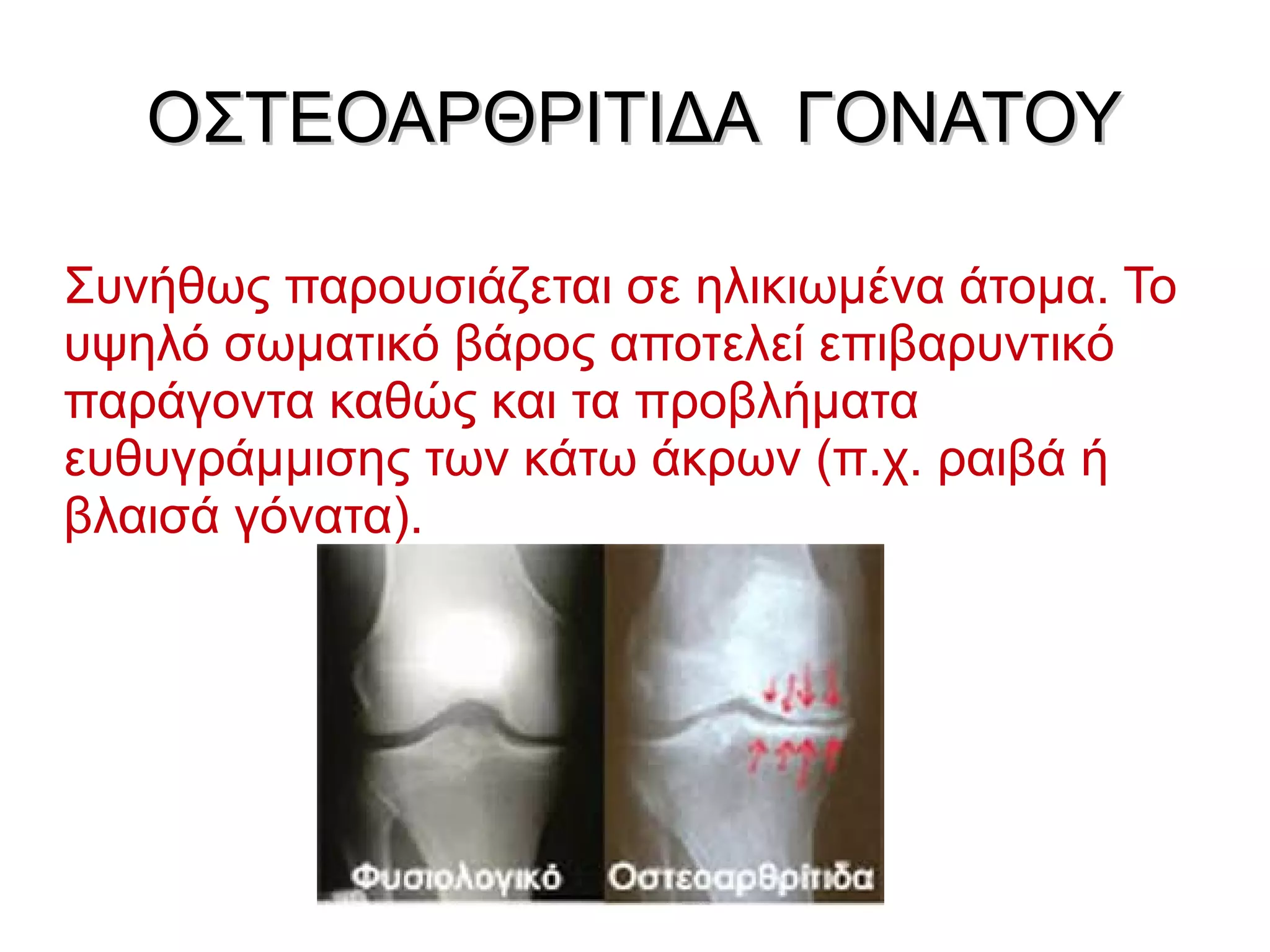 Myoskeletiko | ODP