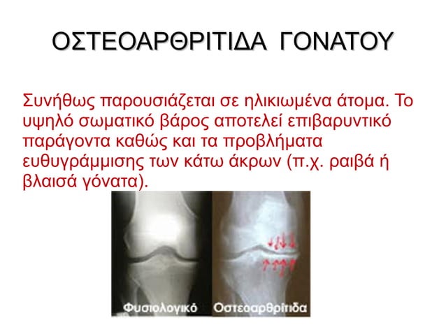 Myoskeletiko | ODP