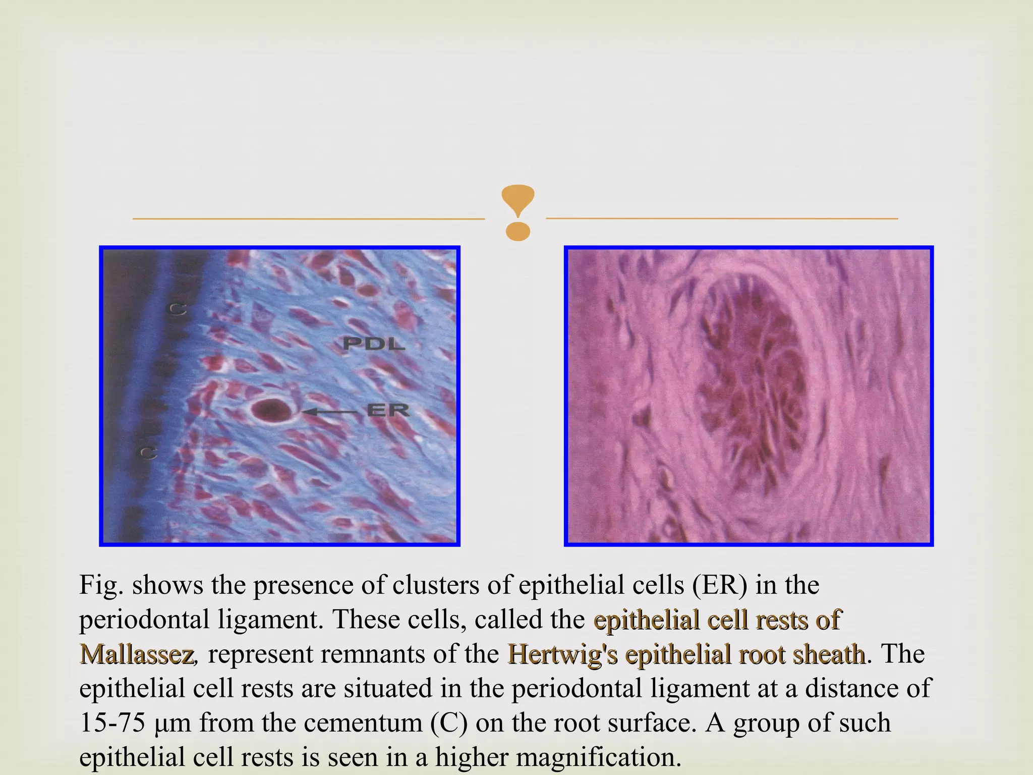 PDL, PERIODONTAL LIGAMENT. | PPT | Dental Health | Diseases and Conditions