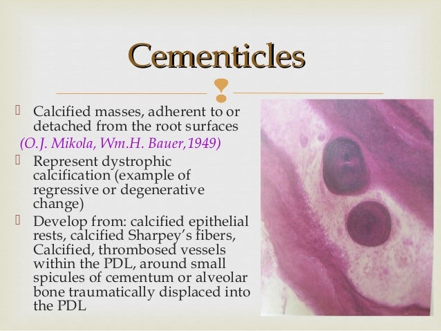 Pdl Periodontal Ligament