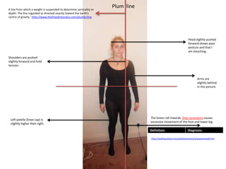 My posture analysis22 | PPTX | Physical Therapy | Wellness