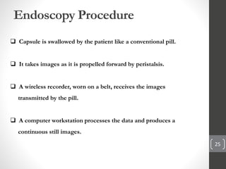 capsule endoscopy | PPT