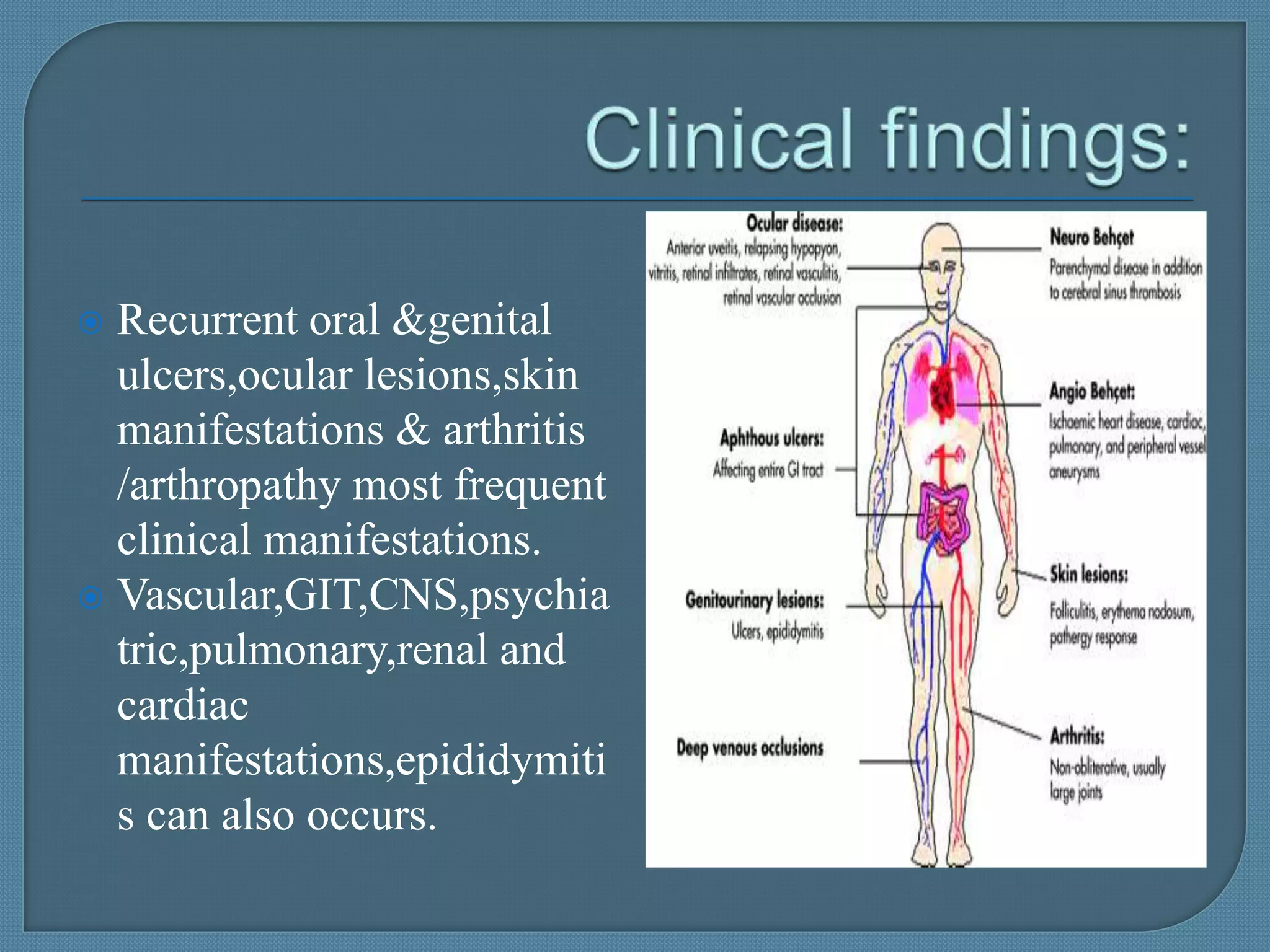behcets disease | PPTX
