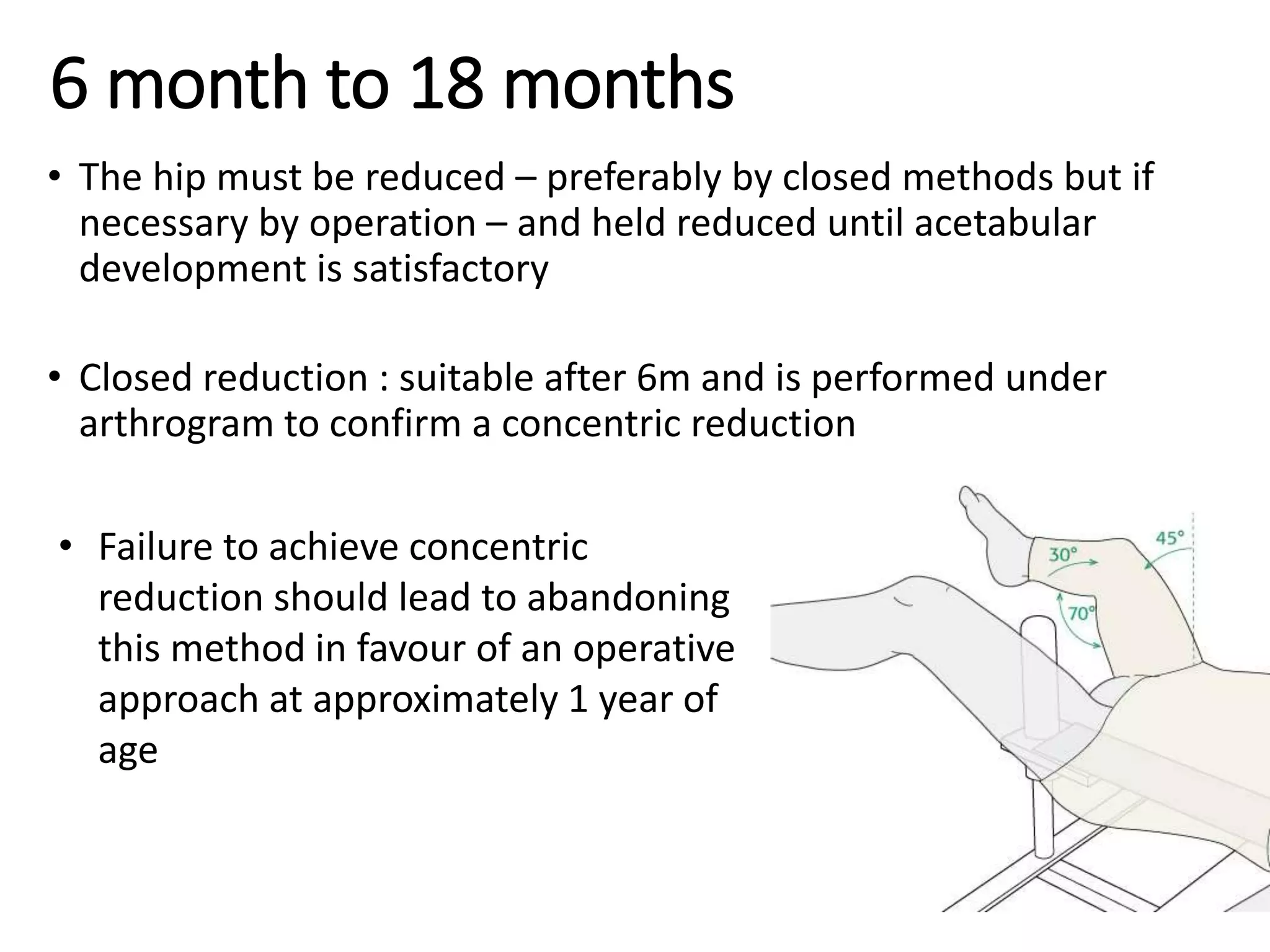 CDH AND DDH | PPTX