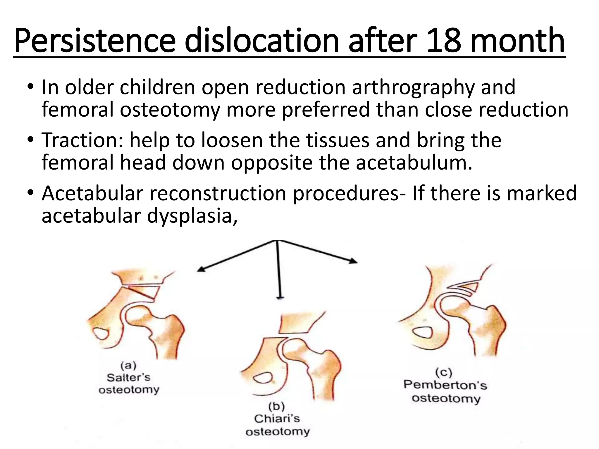 CDH AND DDH | PPTX | Pregnancy | Reproductive Health