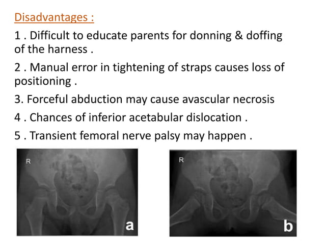 CDH AND DDH | PPTX | Pregnancy | Reproductive Health