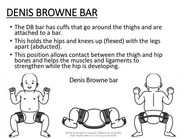 CDH AND DDH | PPTX | Pregnancy | Reproductive Health