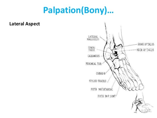 examination of foot and ankle