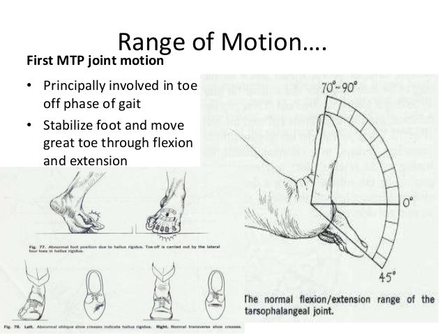 examination of foot and ankle