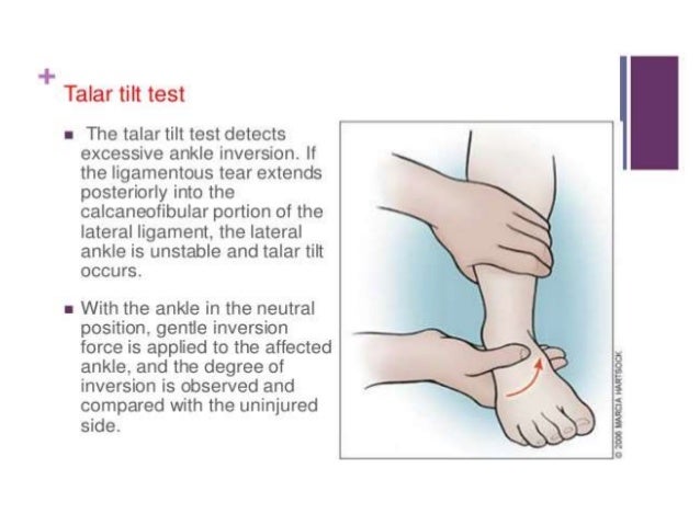 examination of foot and ankle