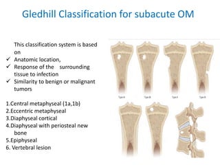 Acute and sub-acute Osteomyelitis | PPT
