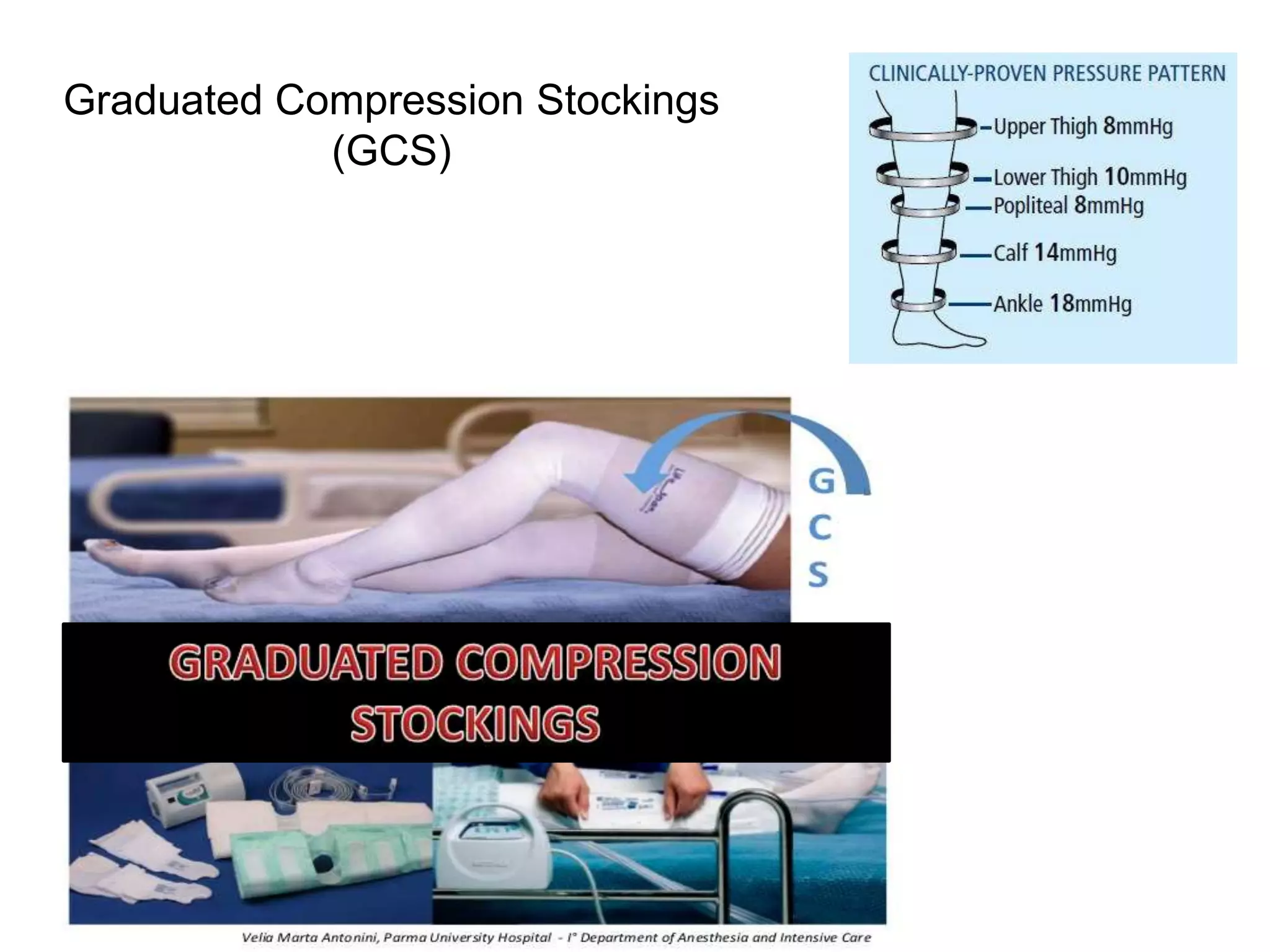 DVT PROPHYLAXIS IN ORTHOPEDIC SURGERIES | PPTX