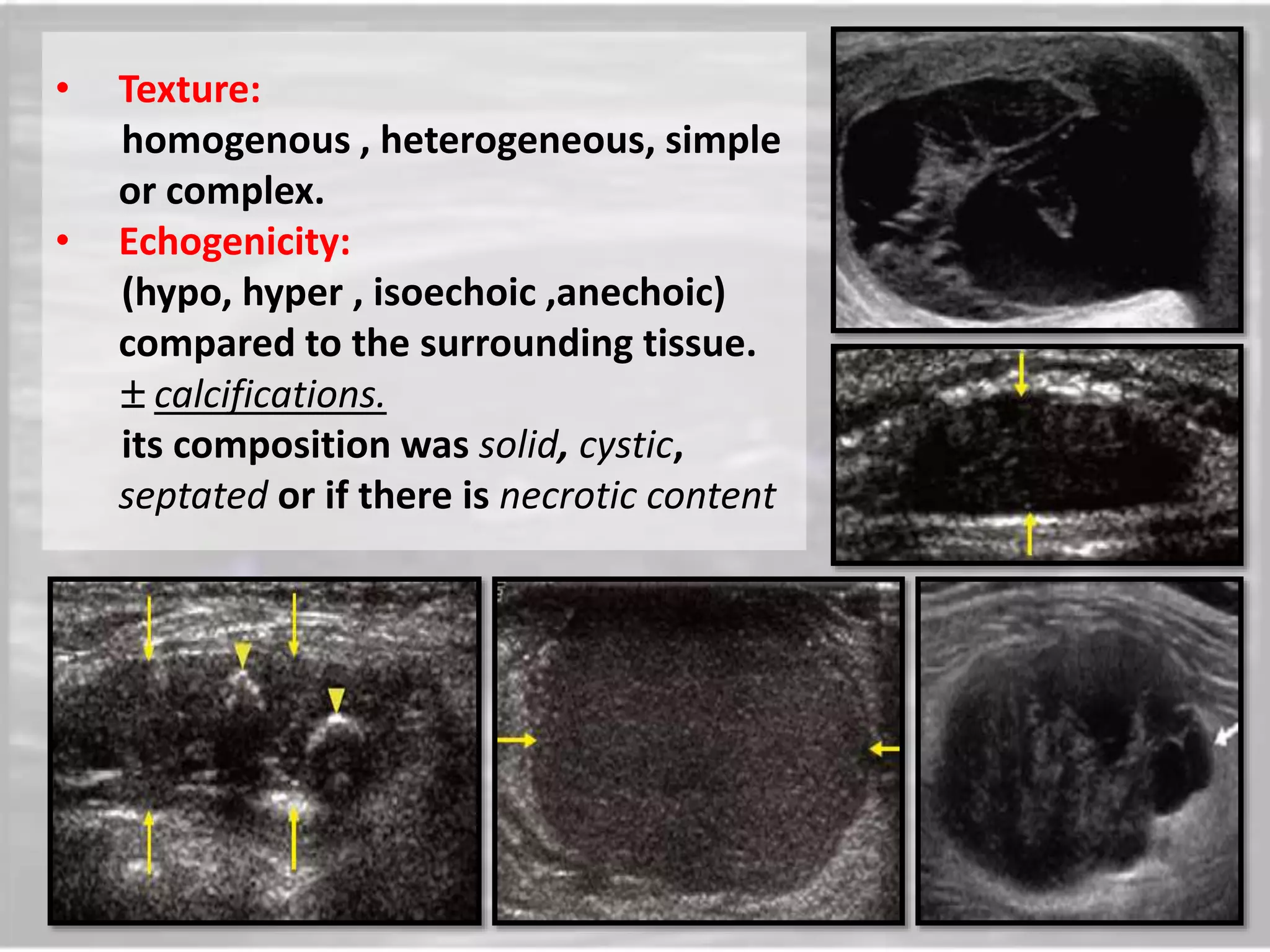 Role of ultrasound and color Doppler in evaluation of musculoskeletal ...