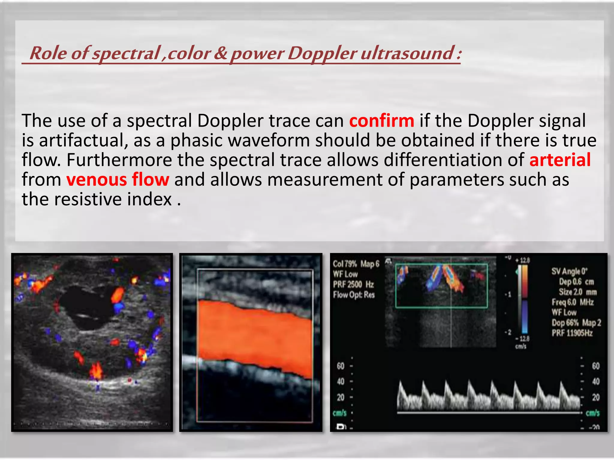 Role of ultrasound and color Doppler in evaluation of musculoskeletal ...