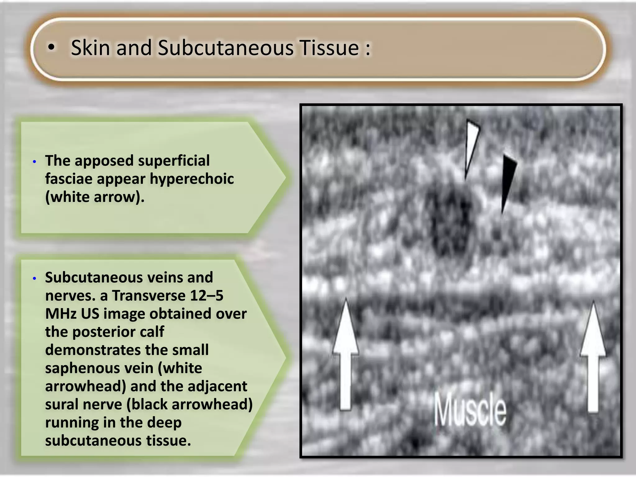 Role of ultrasound and color Doppler in evaluation of musculoskeletal ...