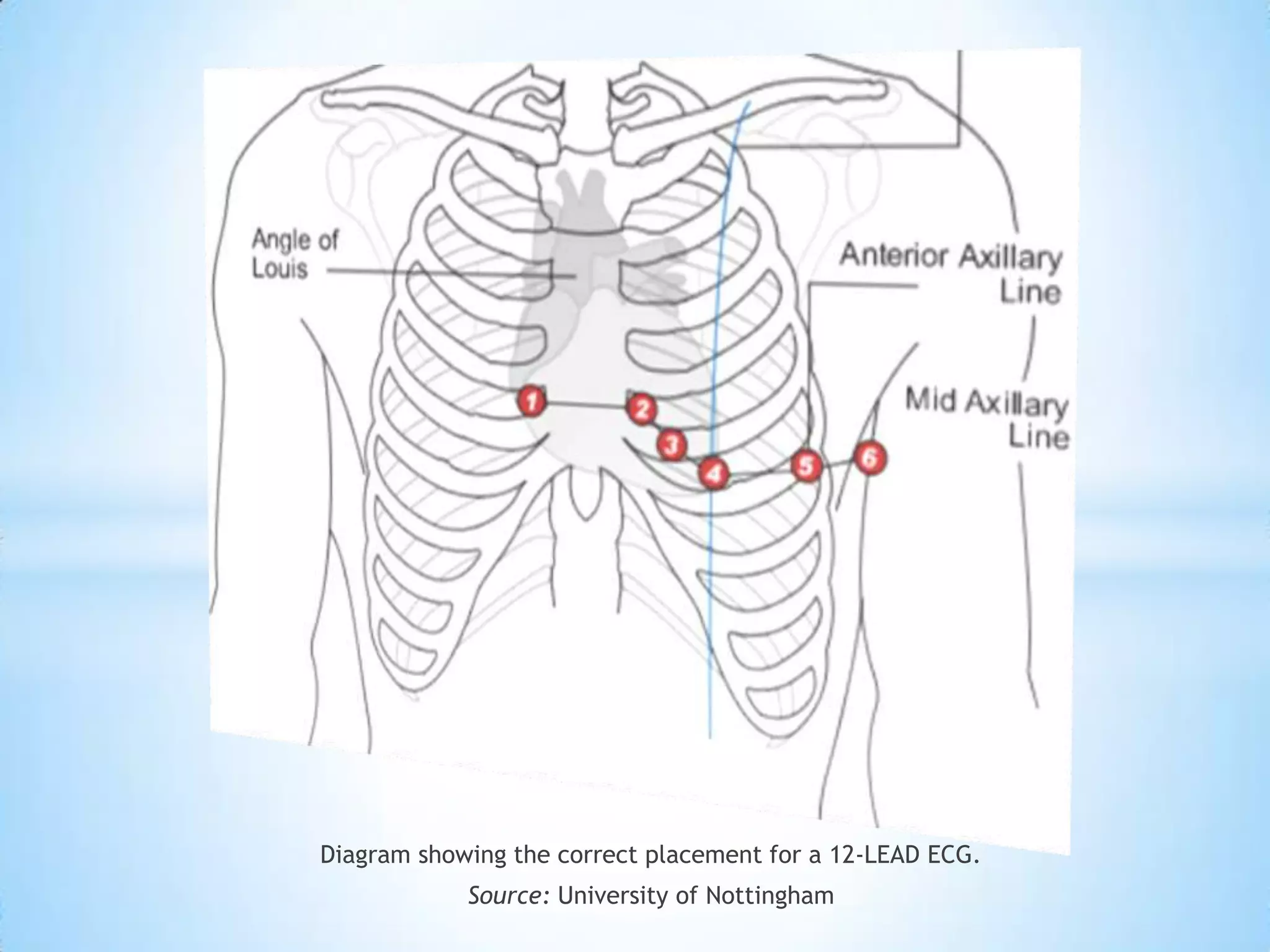 12 lead electrocardiogram | PPTX