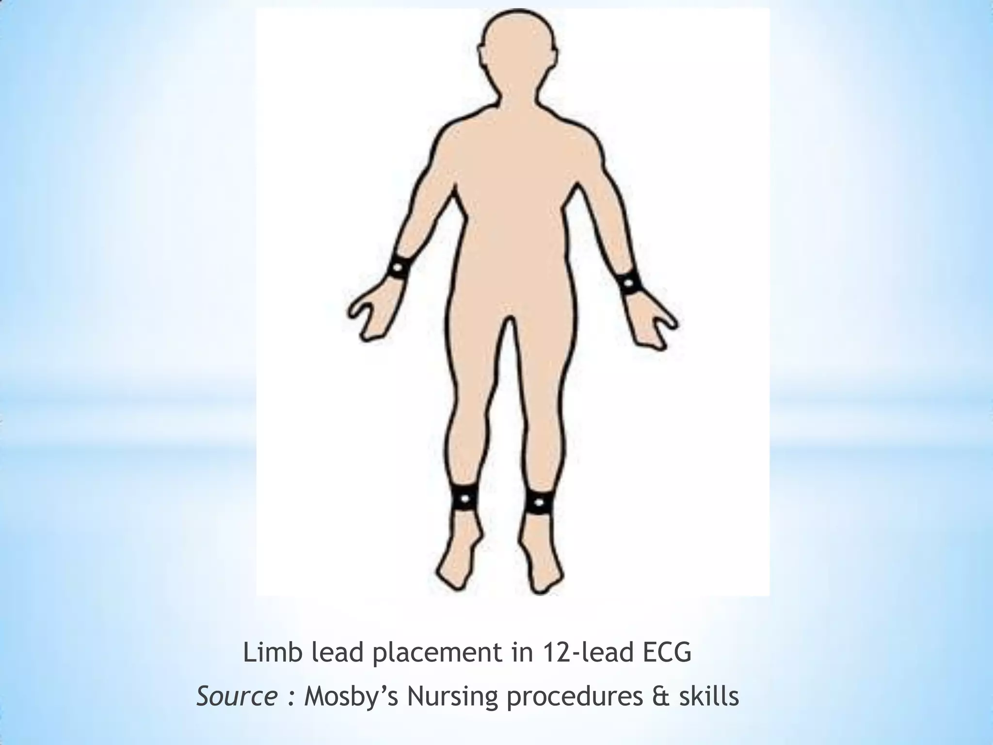 12 lead electrocardiogram | PPTX