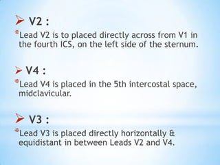 12 lead electrocardiogram | PPTX | Heart and Cardiovascular Diseases ...