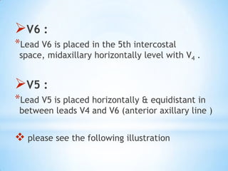 12 lead electrocardiogram | PPTX