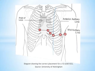 12 lead electrocardiogram | PPTX