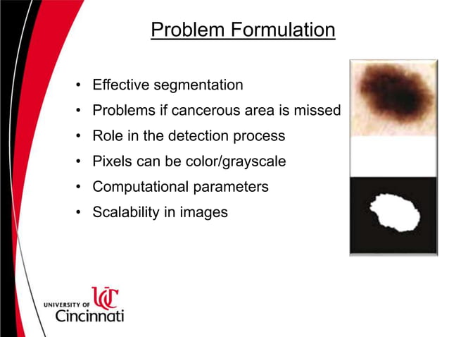 Melanoma Image Segmentation Using Self Organized Features Maps Ppt 